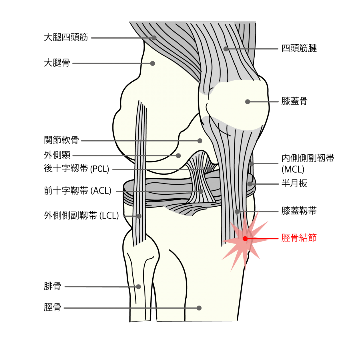 オスグッド・シュラッター病 – Mueller Japan